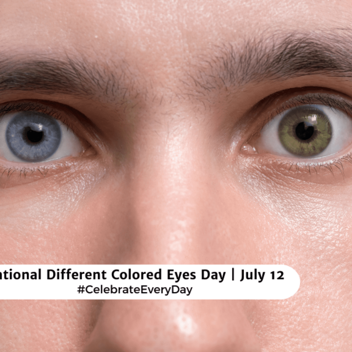 different colored eyes