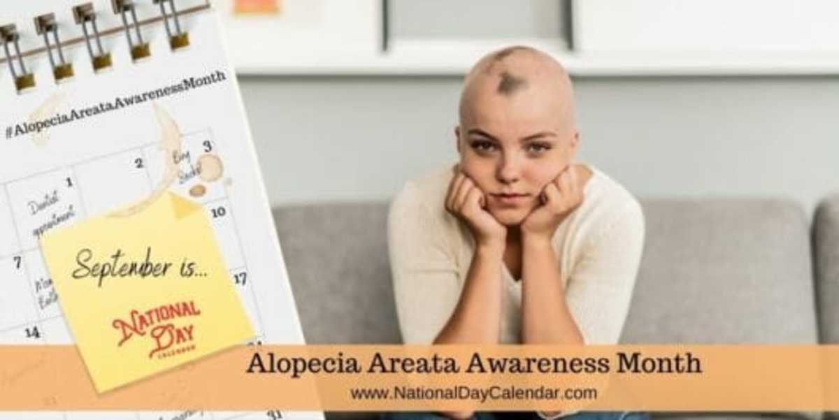 ALOPECIA AREATA AWARENESS MONTH - September - National Day Calendar